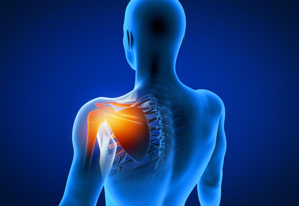 Shoulder Pain Specialist in Riverdale Park, MD | S.I.M.S.